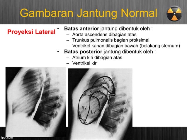 KULIAH RADIOGRAFI TORAKS NORMAL, blok 4.pdf