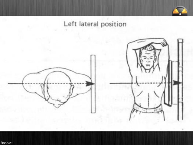 KULIAH RADIOGRAFI TORAKS NORMAL, blok 4.pdf
