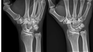 Kuliah Sport Injury X-Ray Alfian.pptx