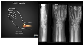 Kuliah Sport Injury X-Ray Alfian.pptx