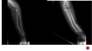 Kuliah Sport Injury X-Ray Alfian.pptx