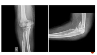 Kuliah Sport Injury X-Ray Alfian.pptx