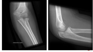 Kuliah Sport Injury X-Ray Alfian.pptx