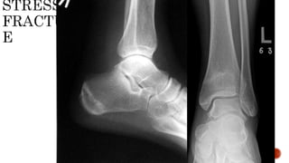 Kuliah Sport Injury X-Ray Alfian.pptx
