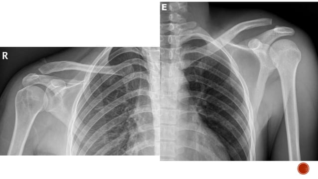 Kuliah Sport Injury X-Ray Alfian.pptx