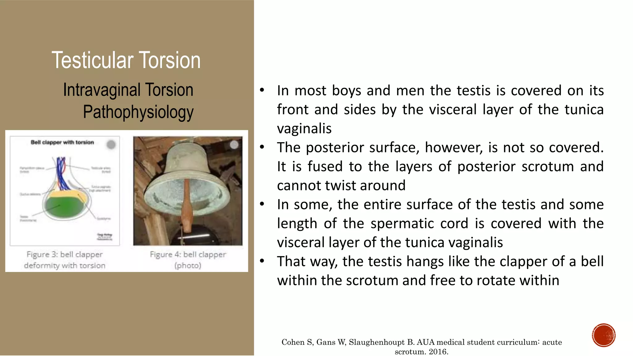 KULIAH SUBUH TORSIO TESTIS.pptx