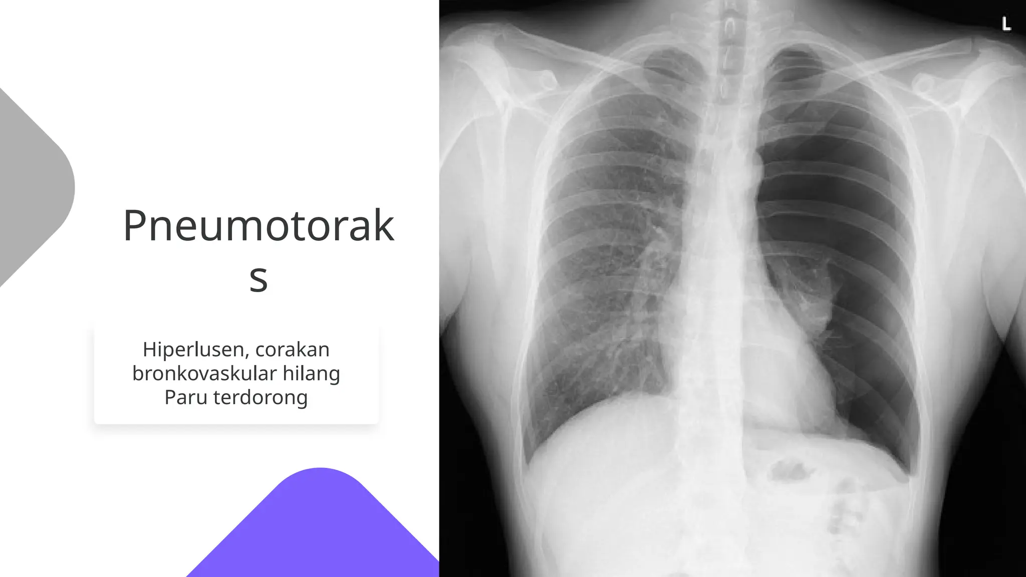 Kuliah Dasar Radiologi dan Patologi Toraks | PPT