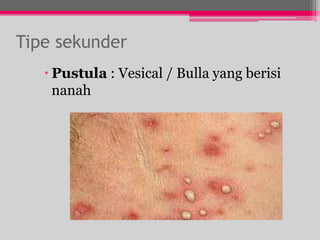 Kulit rambut dan kuku | PPTX