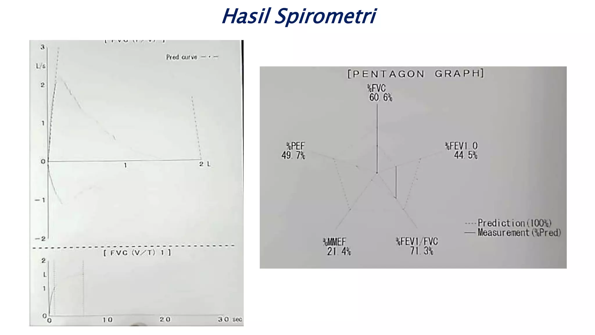 Kumpulan Spirometri Cases Final.pptx