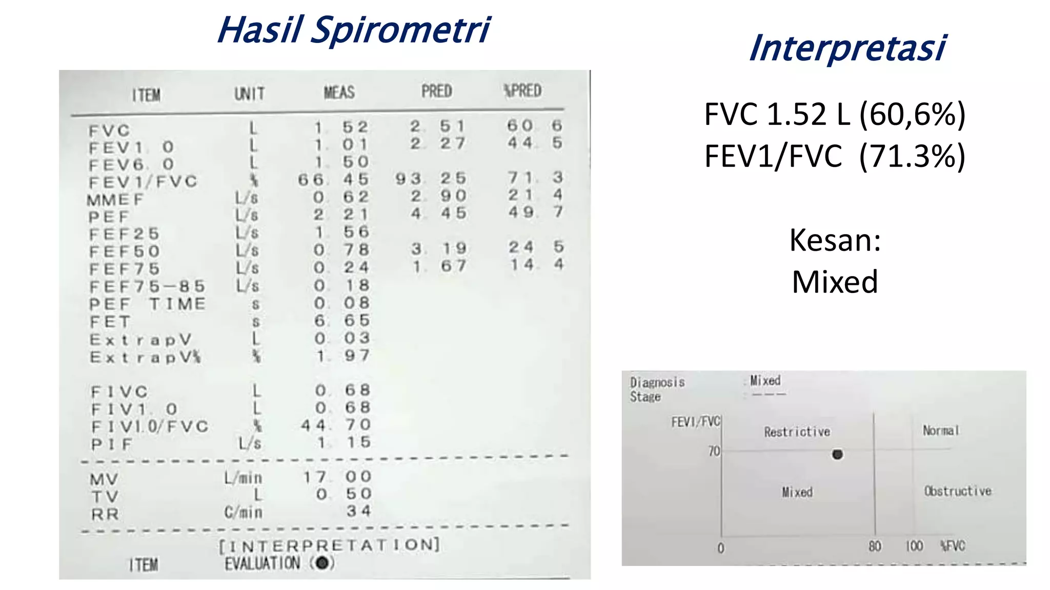 Kumpulan Spirometri Cases Final.pptx