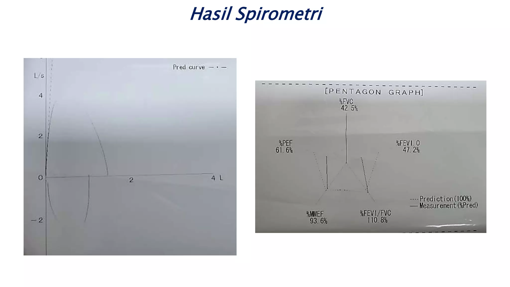 Kumpulan Spirometri Cases Final.pptx
