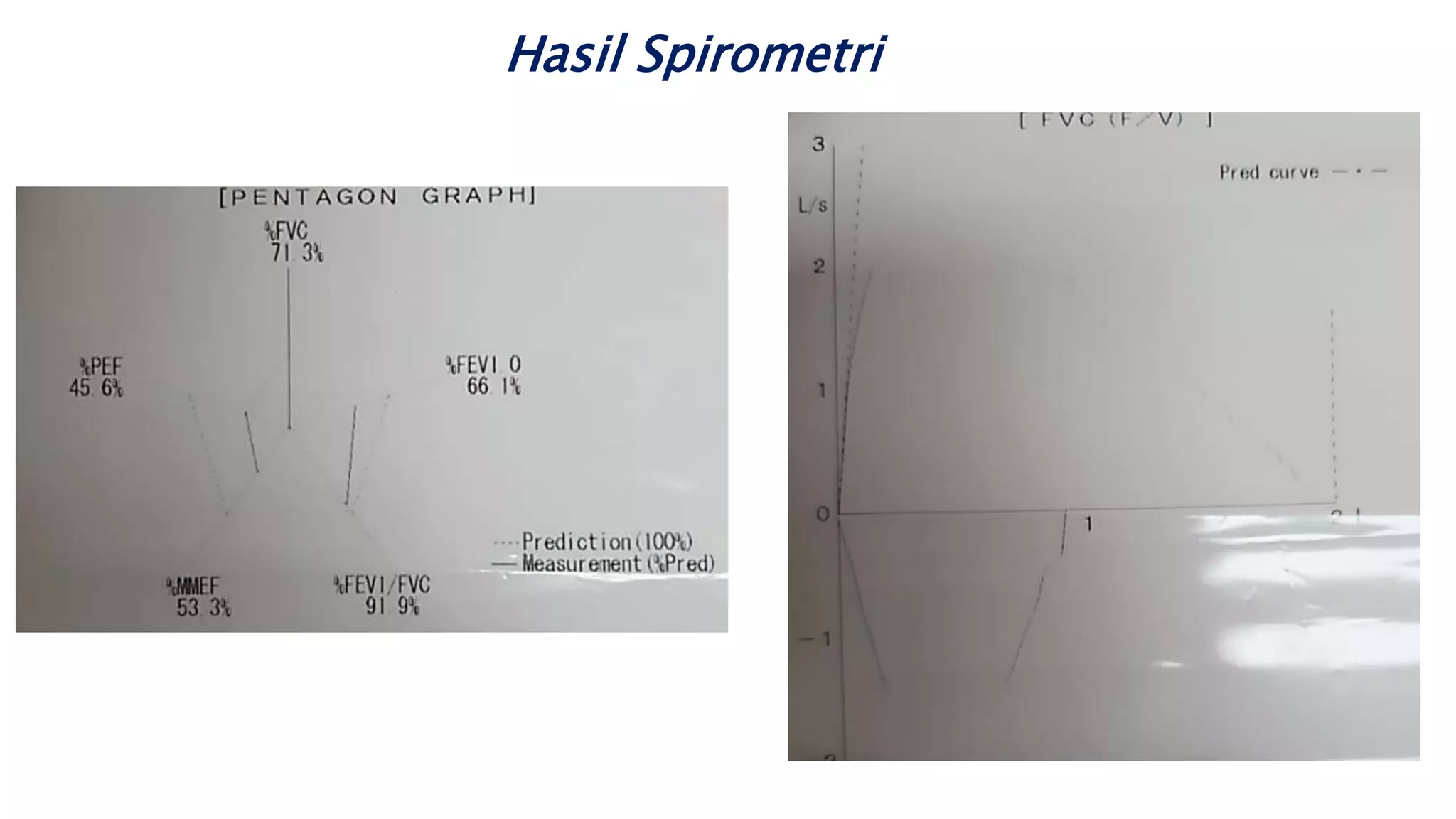 Kumpulan Spirometri Cases Final.pptx