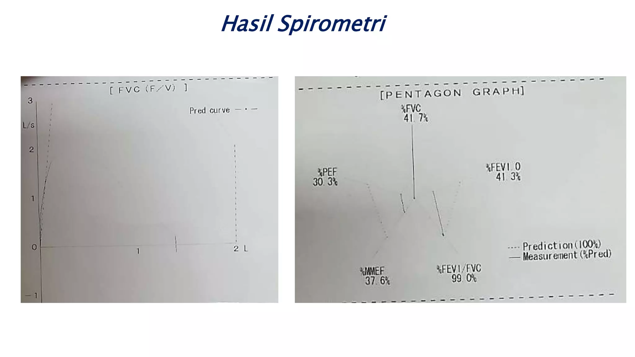 Kumpulan Spirometri Cases Final.pptx
