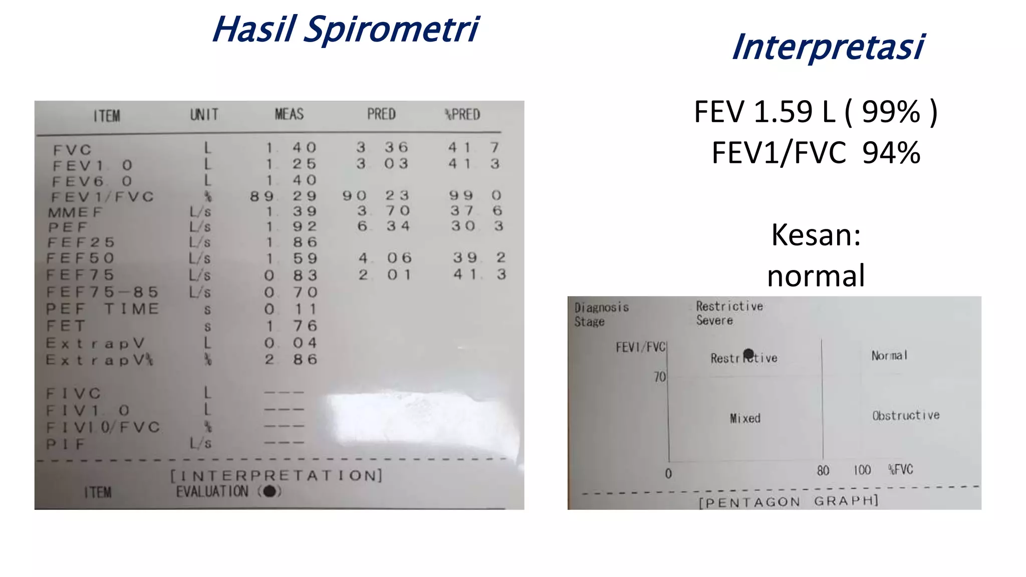 Kumpulan Spirometri Cases Final.pptx