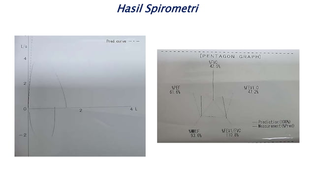 Kumpulan Spirometri Cases Final.pptx
