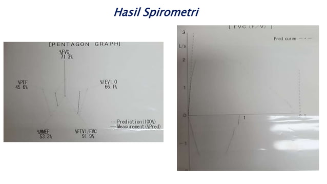 Kumpulan Spirometri Cases Final.pptx