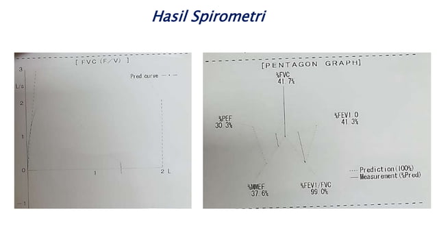 Kumpulan Spirometri Cases Final.pptx
