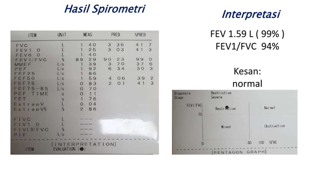 Kumpulan Spirometri Cases Final.pptx