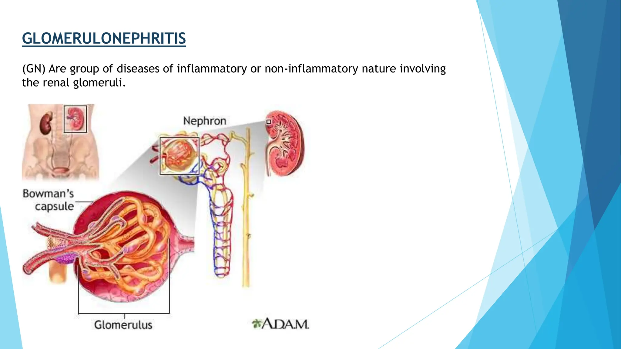 Glomerulonephritis topic kidney related disease | PPTX