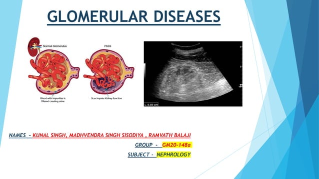 Glomerulonephritis topic kidney related disease | PPT