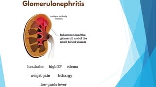 Glomerulonephritis topic kidney related disease | PPTX