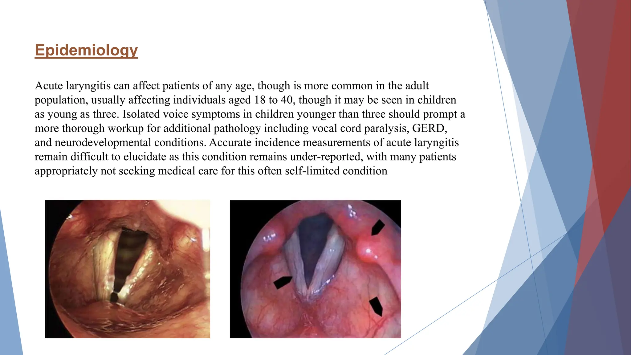 Kunal Singh .Topic-4.Diseases of the larynx.ENT.GM20-148.pptx