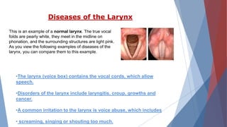 Kunal Singh .Topic-4.Diseases of the larynx.ENT.GM20-148.pptx | Lung ...