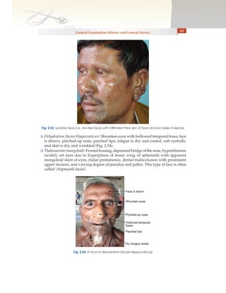 kundus-practical-medicine-2e-second-edition-9789354669897_compress.pdf