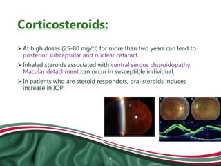Ocular side effect of common systemic drugs. | PPTX