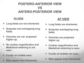 RADIOGRAPHY OF CHEST AND SPINE | PPTX