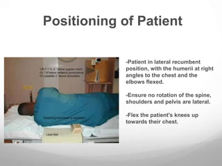 RADIOGRAPHY OF CHEST AND SPINE | PPTX