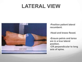 RADIOGRAPHY OF CHEST AND SPINE | PPTX