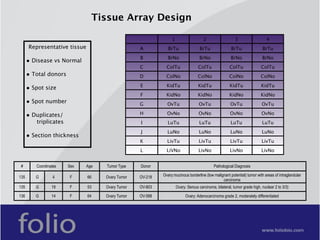 Tissue Microarray presentation | KEY