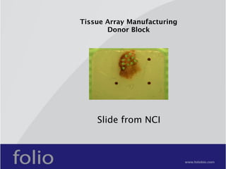 Tissue Microarray presentation | KEY
