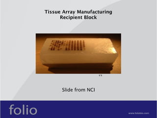 Tissue Microarray presentation | KEY