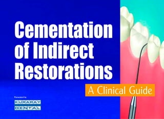Kuraray cementation indirect_restorations_guide | PDF