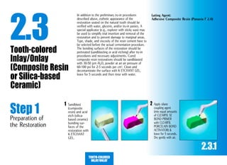 Kuraray cementation indirect_restorations_guide | PDF