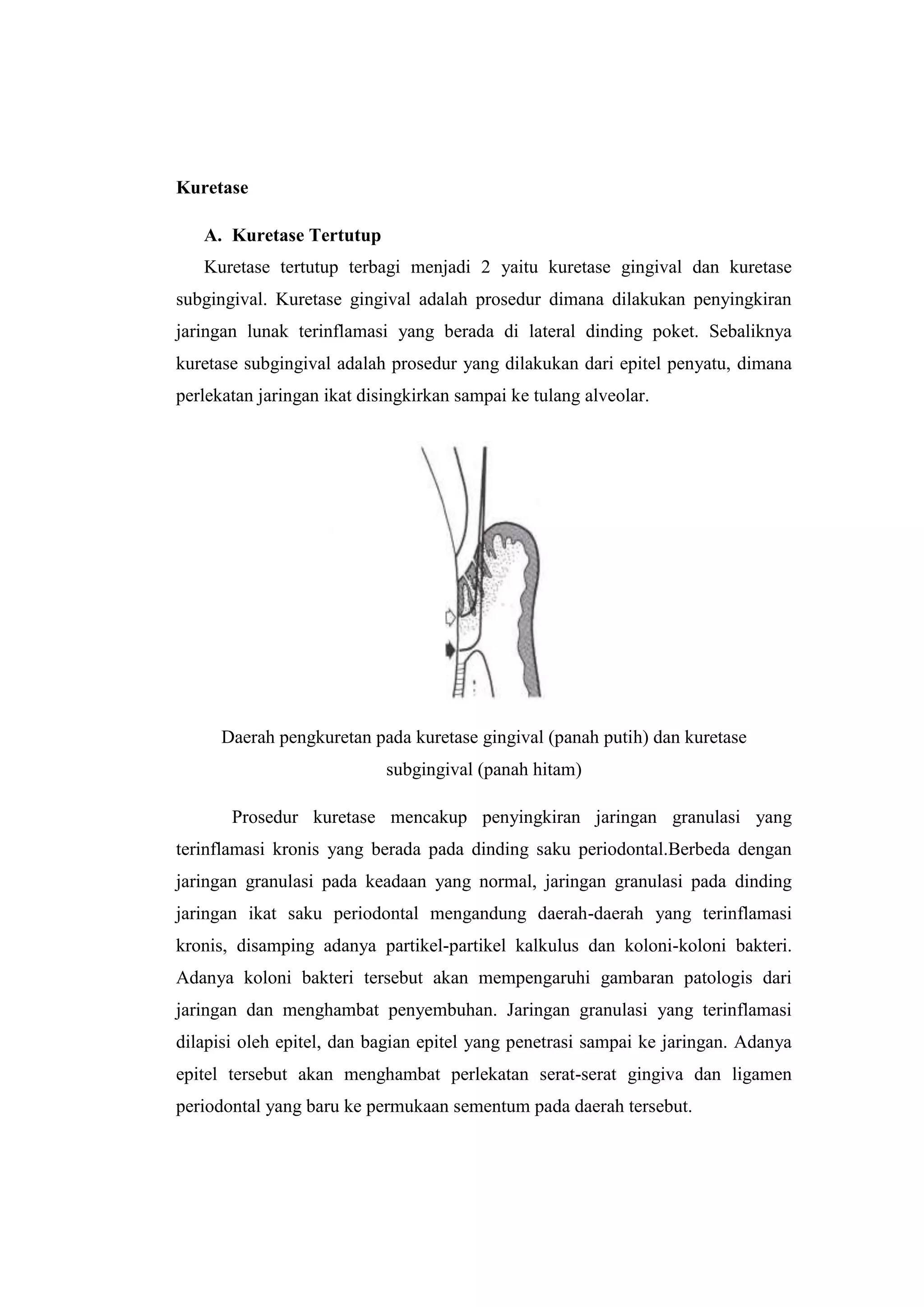 Kuretase | DOCX