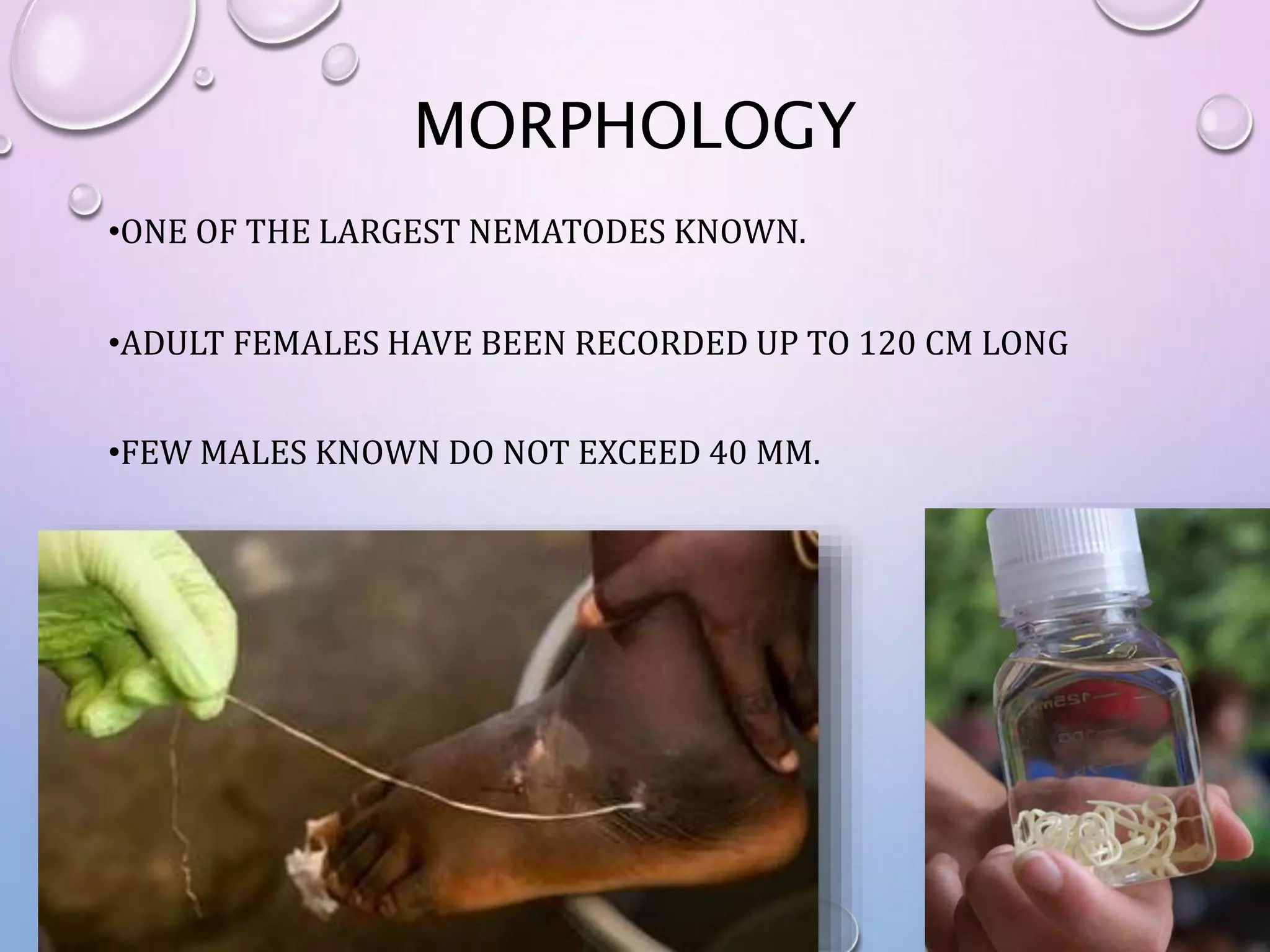 Dracunculus medinensis - Guinea Worm | PPTX