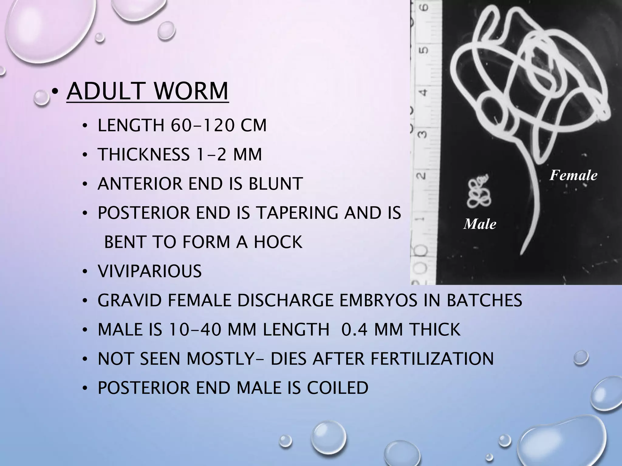 Dracunculus medinensis - Guinea Worm | PPTX