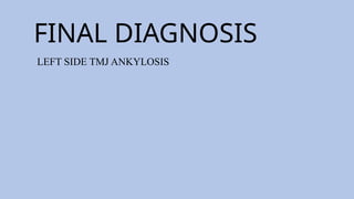 temporomandibular joint ankylosis ankylosis and its management | PPT