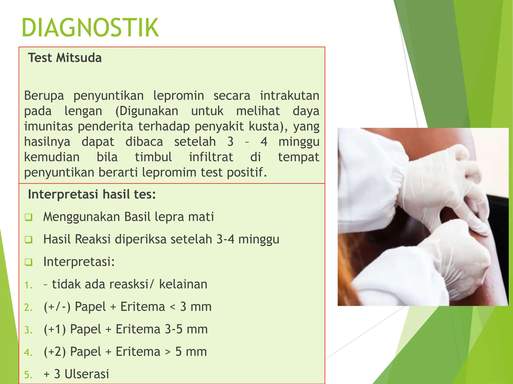 asuehan keperawatan pada pasien dengan penyakit kusta | PPTX