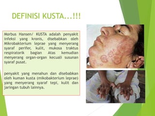 asuehan keperawatan pada pasien dengan penyakit kusta | PPTX