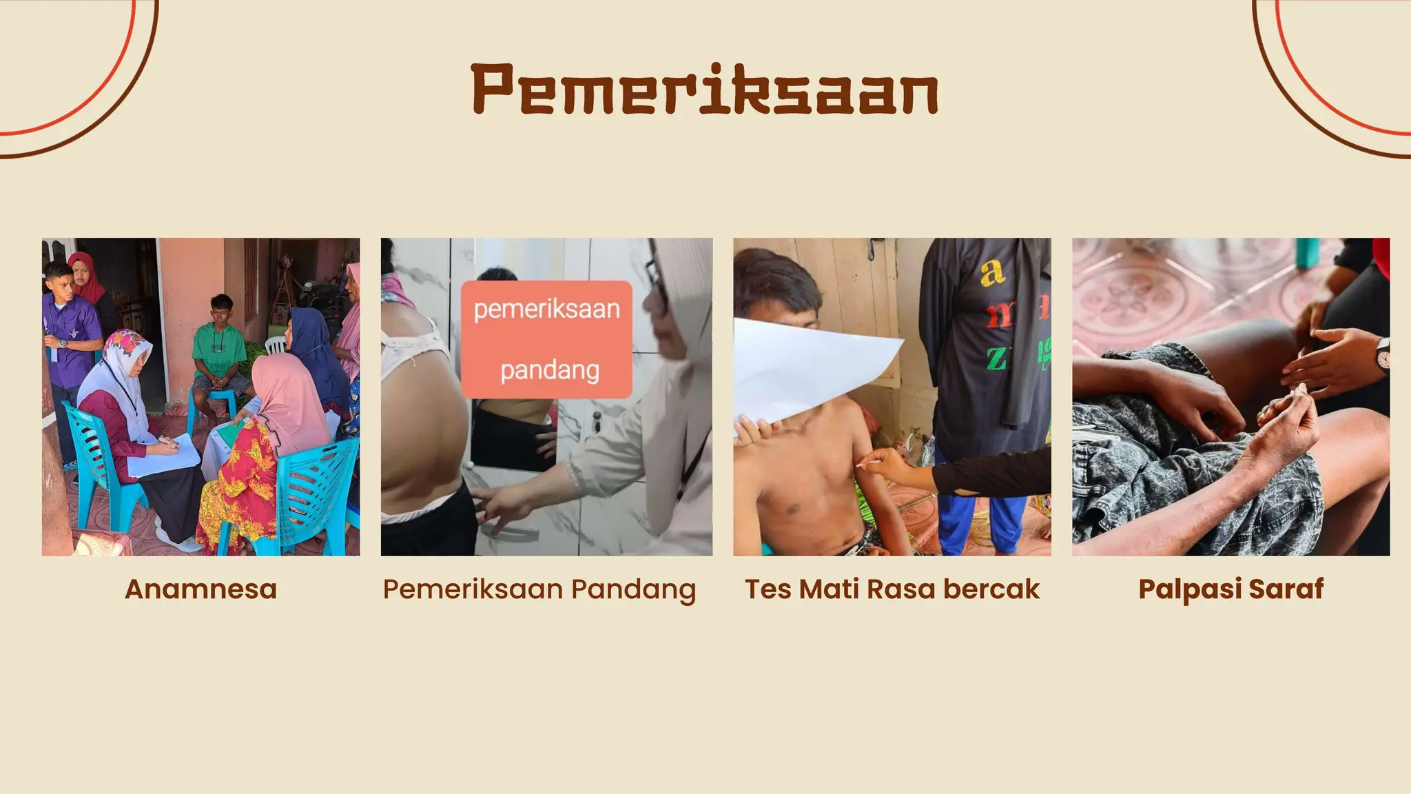 pengertian, tanda dan gejala dan penanganan kusta | PPTX
