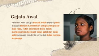 pengertian, tanda dan gejala dan penanganan kusta | PPTX