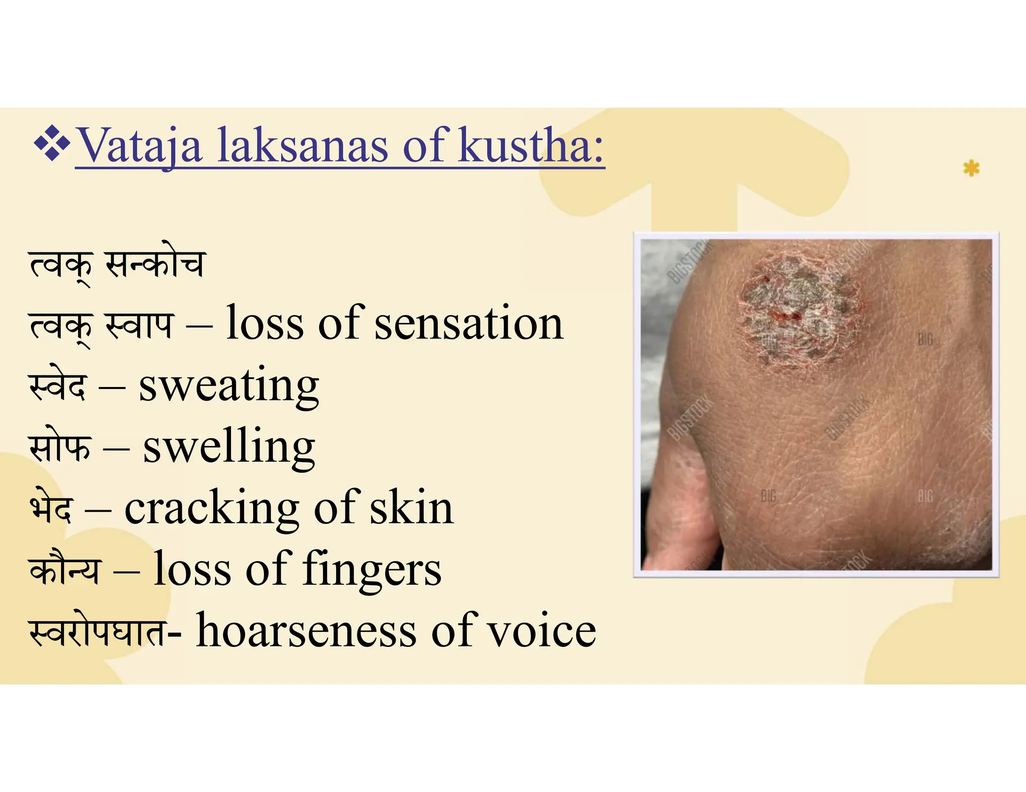KUSTHA PPT .pdf KUSTHA definition, classification, and modern probable ...