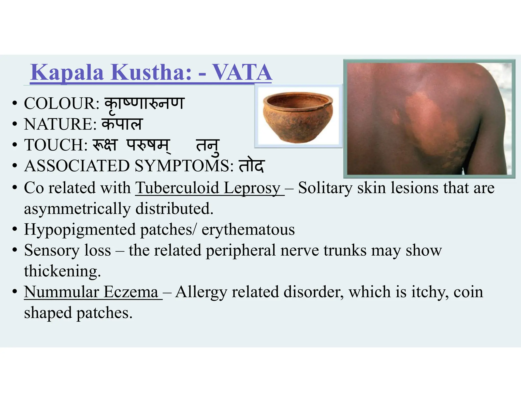 KUSTHA PPT .pdf KUSTHA definition, classification, and modern probable ...