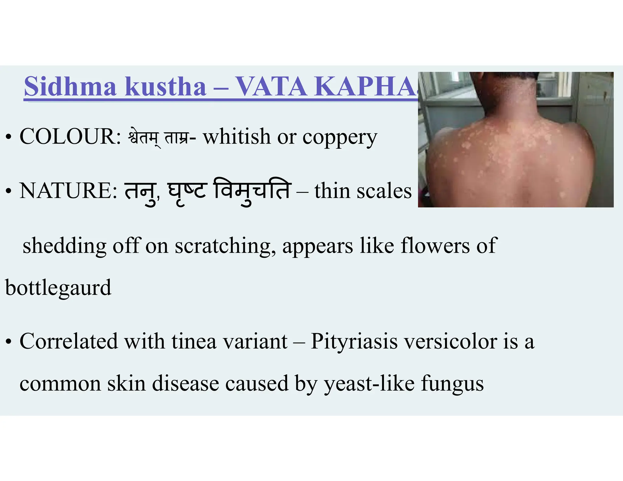 KUSTHA PPT .pdf KUSTHA definition, classification, and modern probable ...