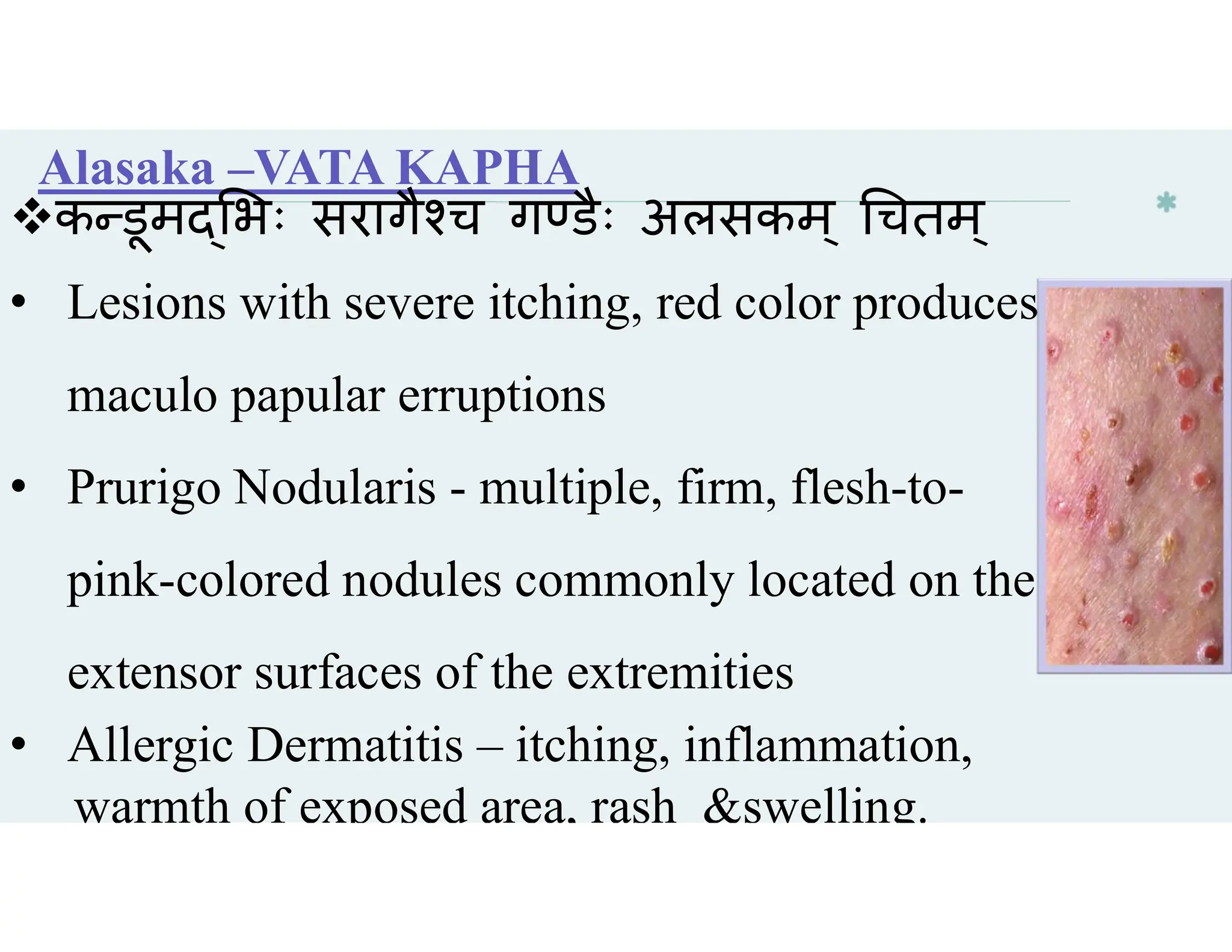KUSTHA PPT .pdf KUSTHA definition, classification, and modern probable ...