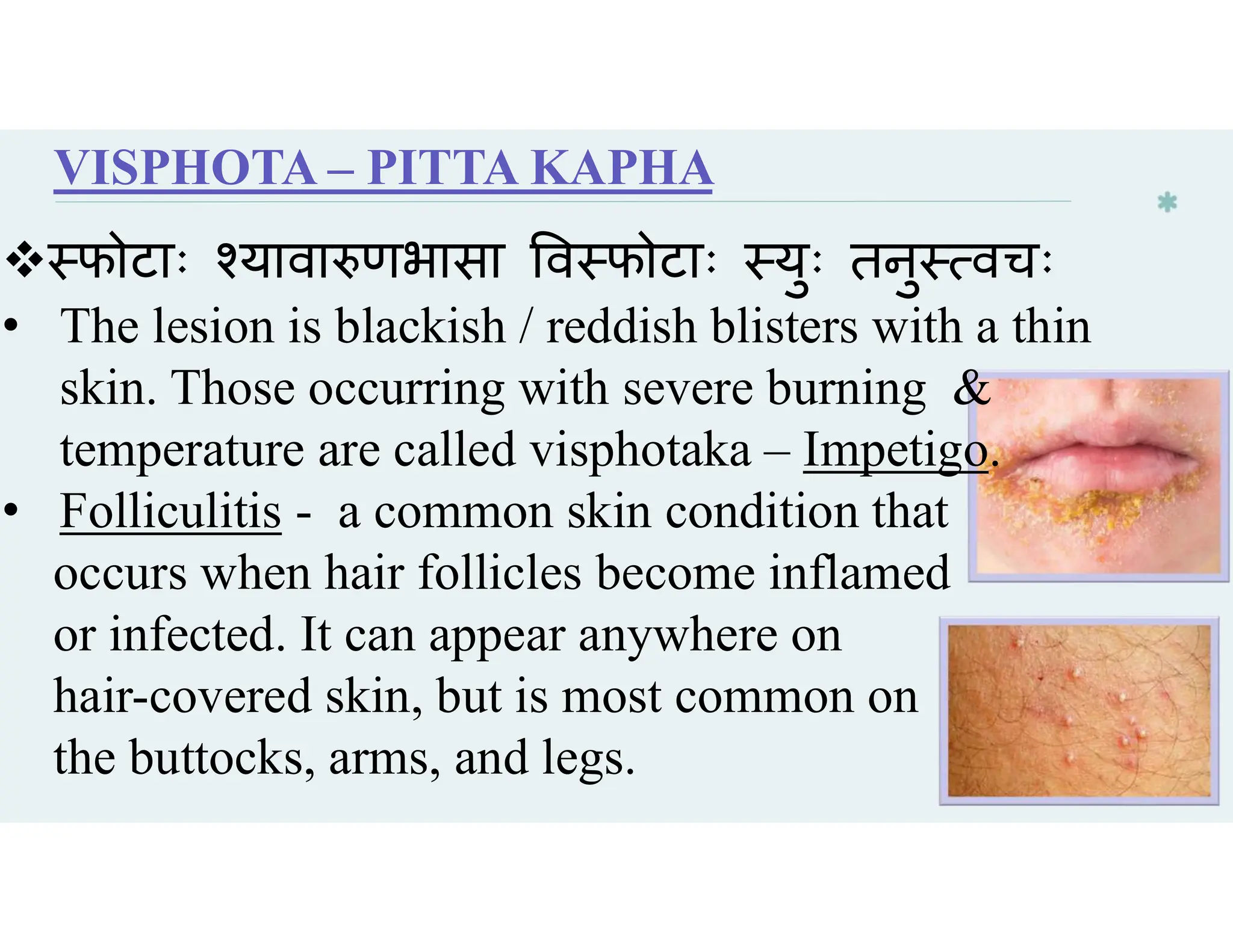 KUSTHA PPT .pdf KUSTHA definition, classification, and modern probable ...